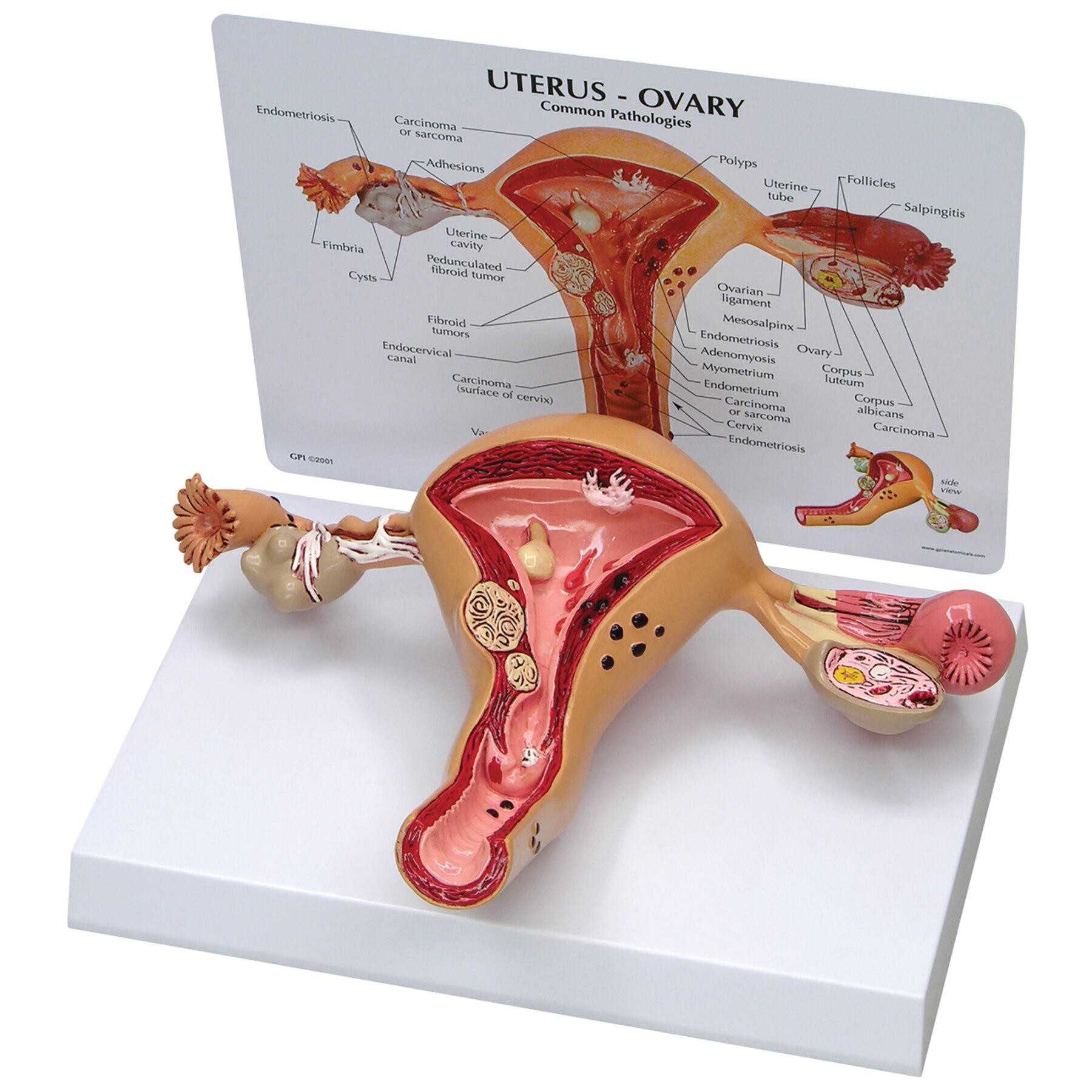 Uterus Ovary Model Health Edco Health Education Models