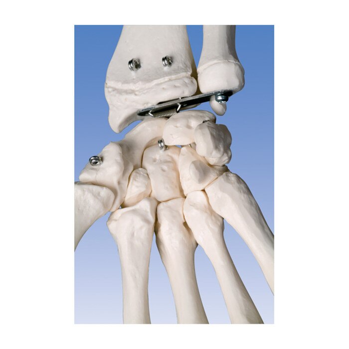 Standard Skeleton Model | Health Edco | Anatomy Models