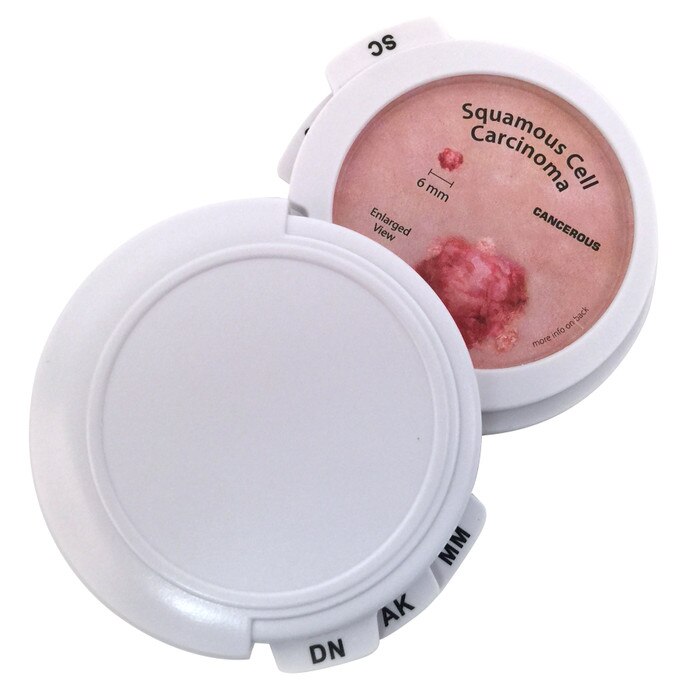 How to Identify Skin Cancer Visual Disk Set | Health Edco