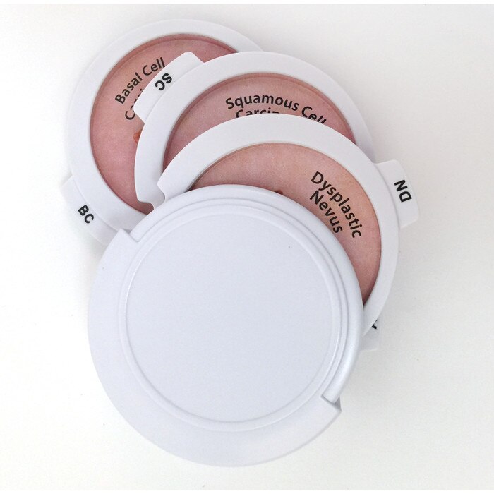 How to Identify Skin Cancer Visual Disk Set | Health Edco