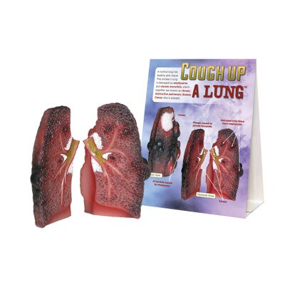 A Year's Worth Of Tar Tobacco Education Model | Health Edco