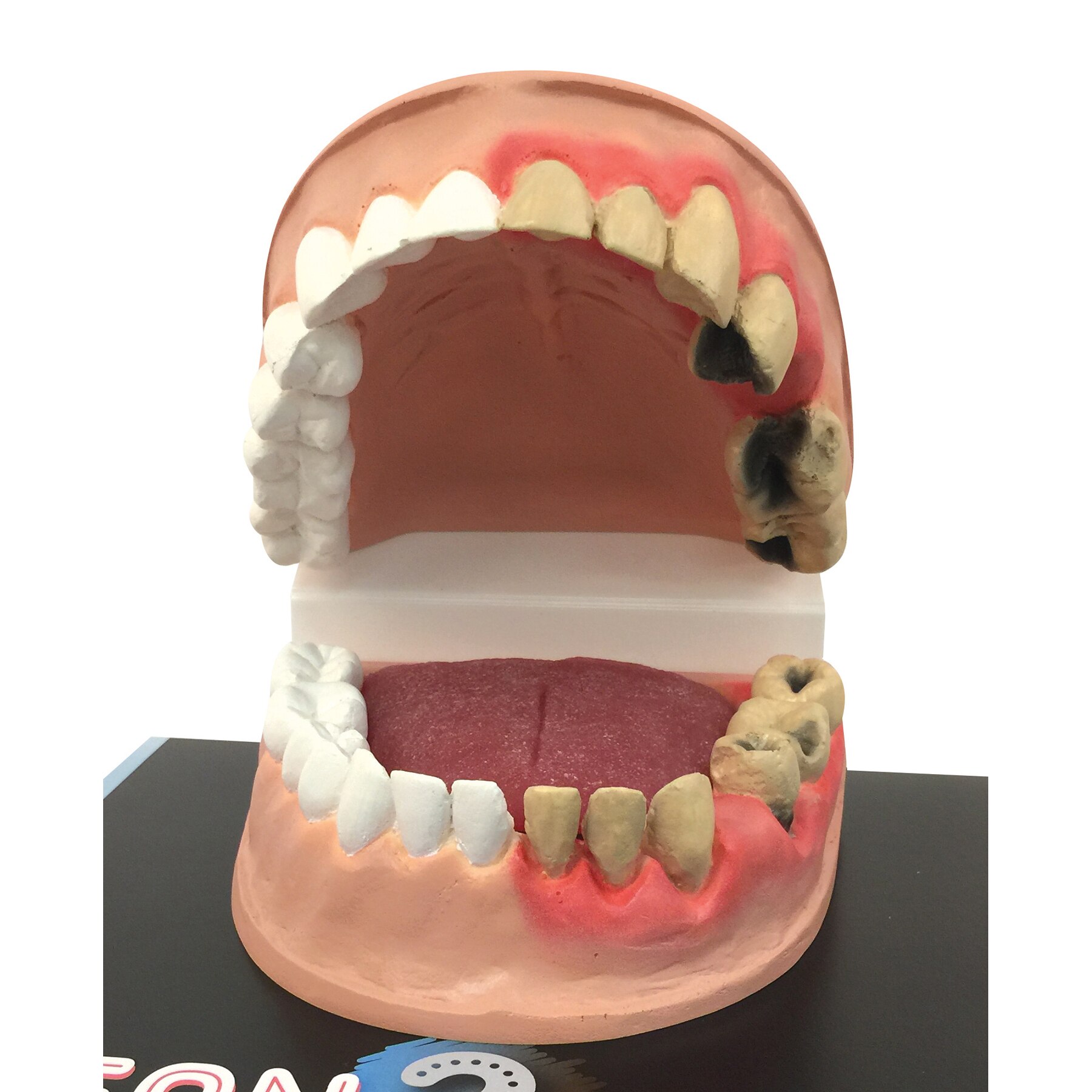 Model Of Mouth And Teeth