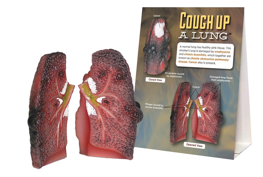 COPD Education Models | Tobacco Teaching Tools | Health Edco