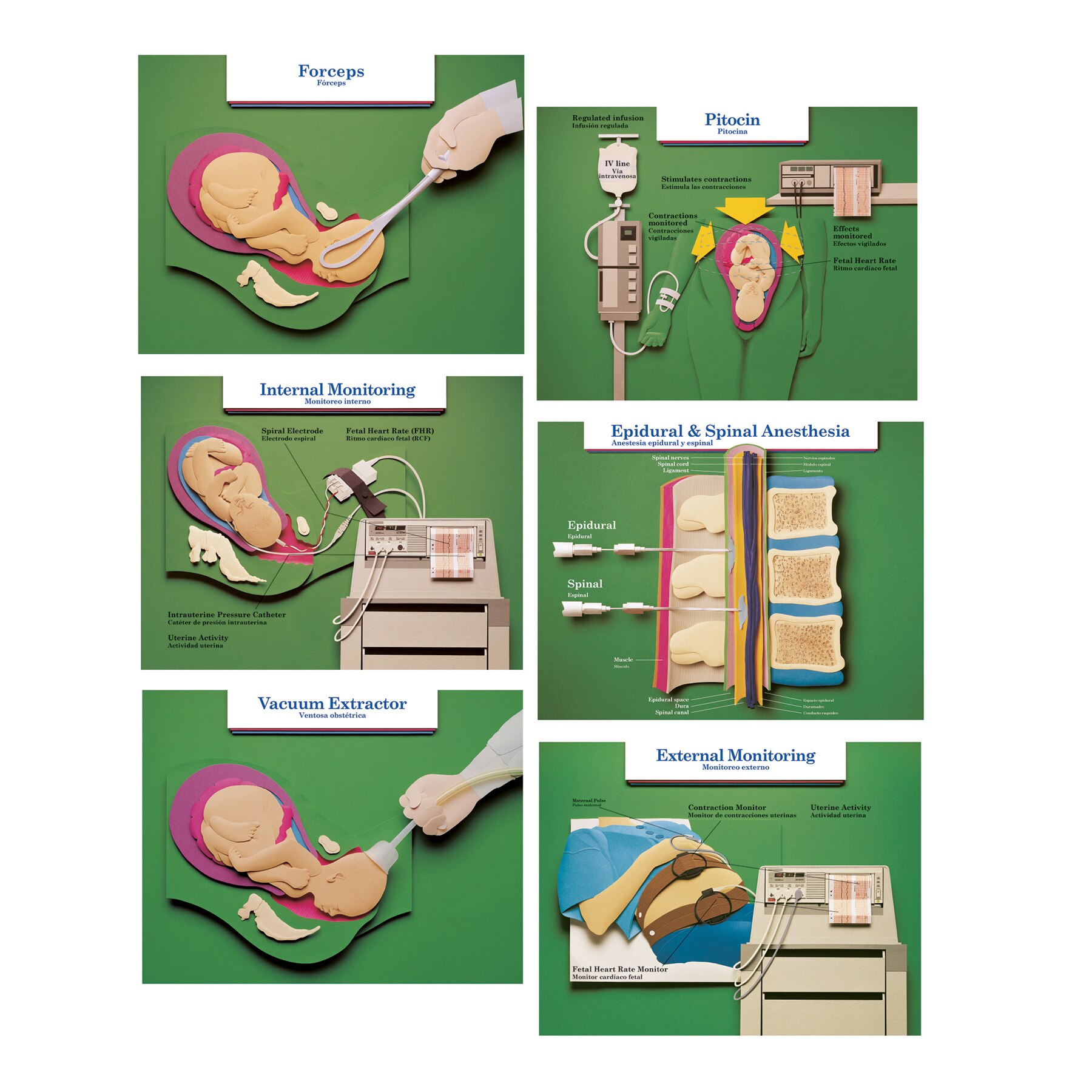 Domino Effect Of Birth Interventions Childbirth Graphics Domino Effect Of Birth Interventions Childbirth Graphics